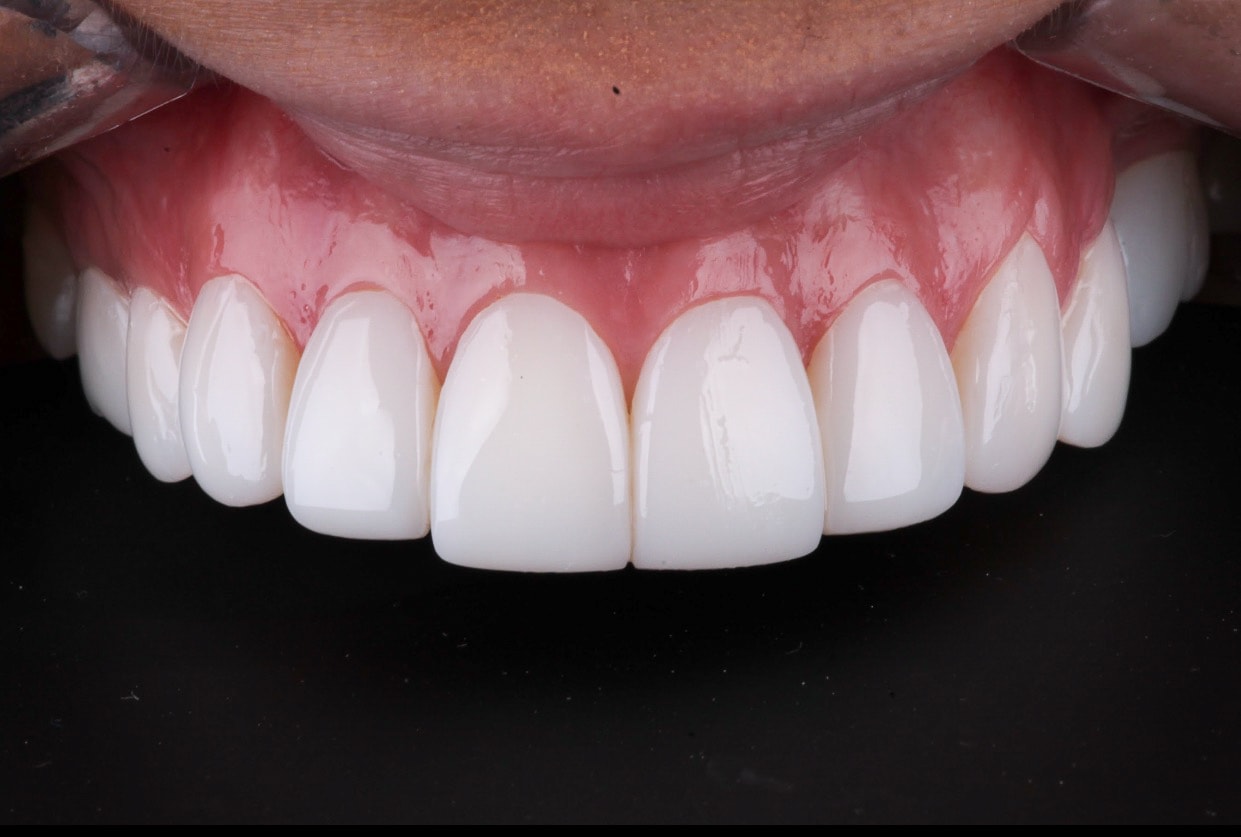 Estética Dental – Dr Daniel Córdoba